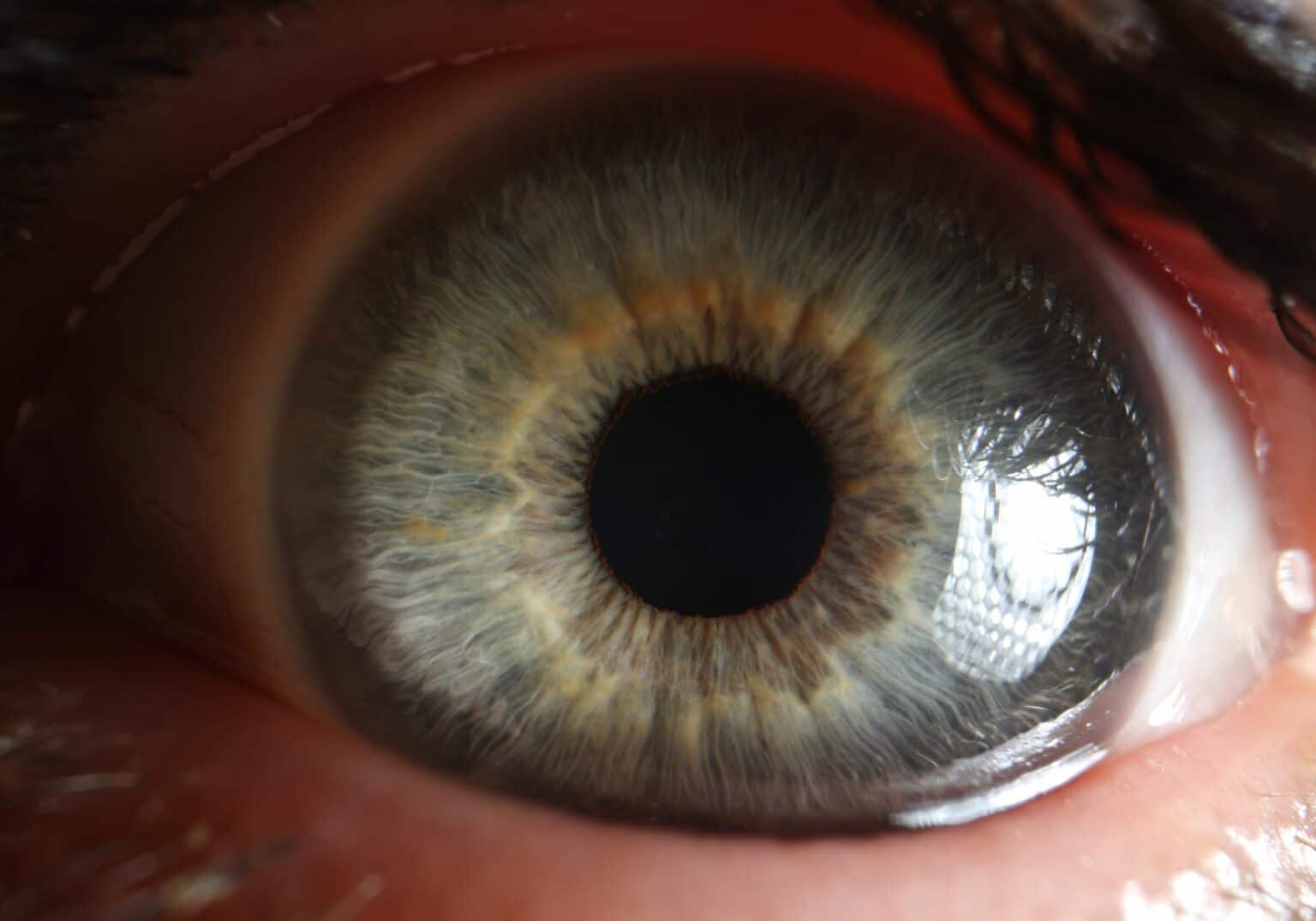 Danger Opioid Overdose: Signs, Symptoms and Treatment