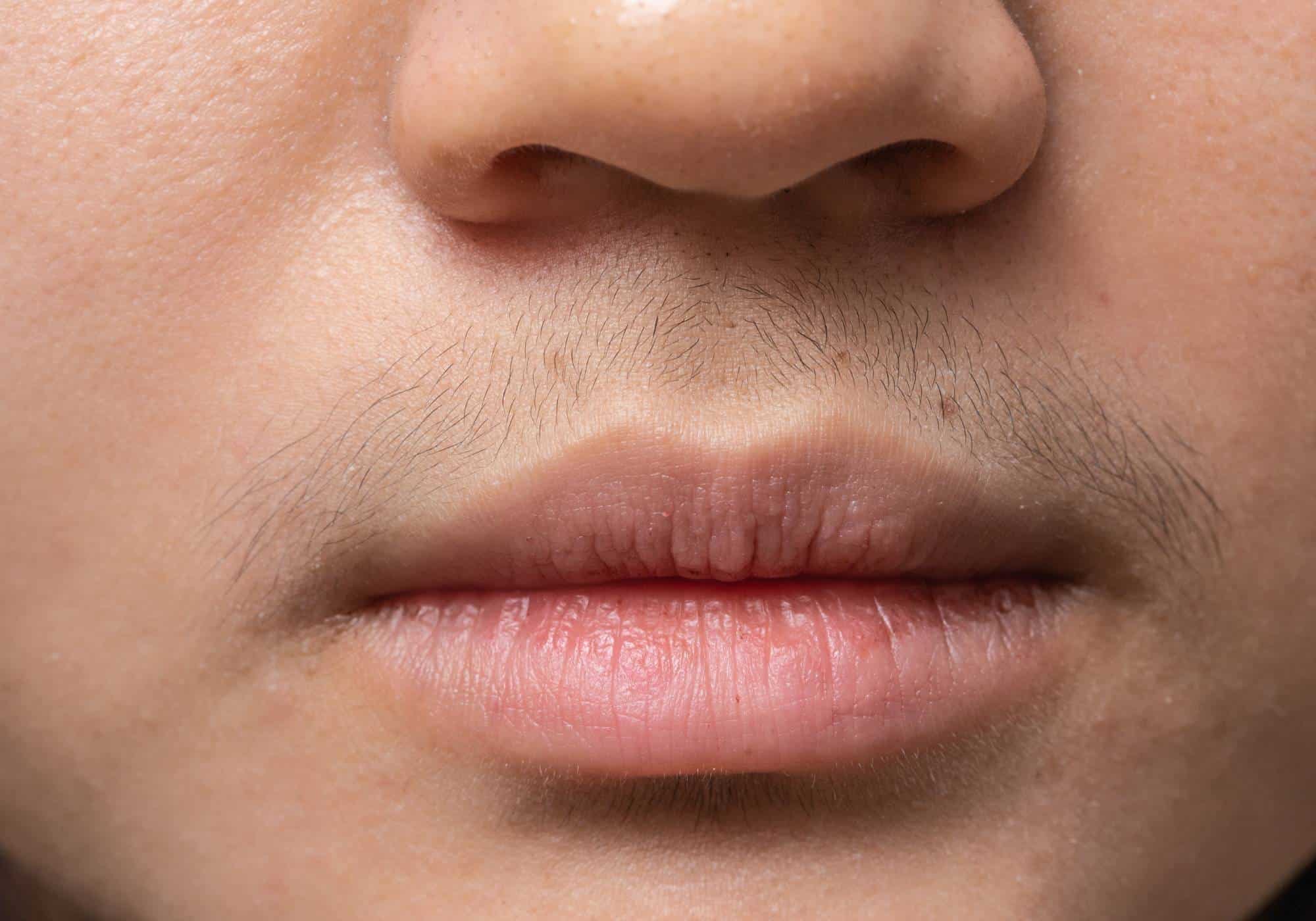 Steroid Addiction: Signs, Symptoms, Effects and Treatment