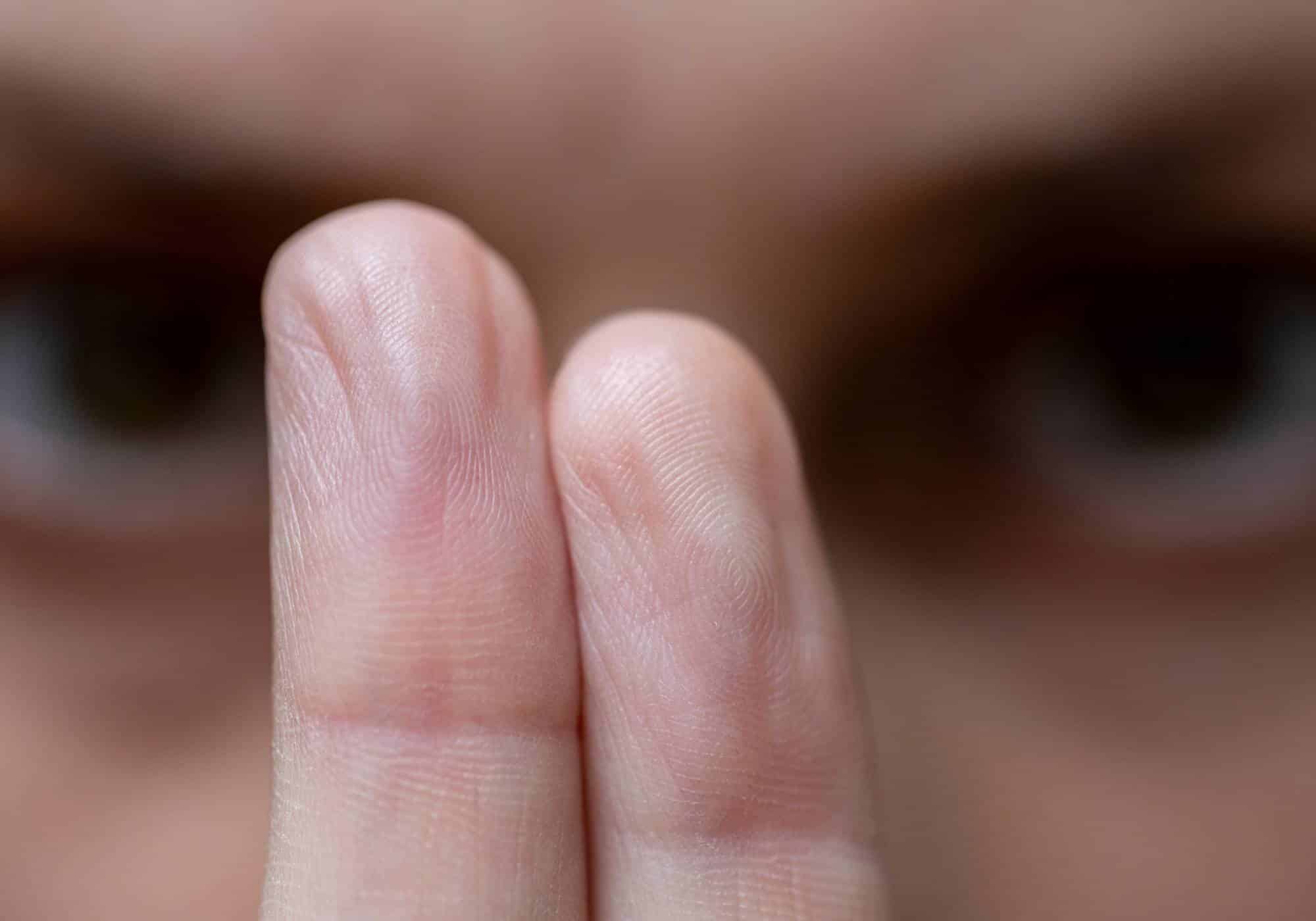 Accelerated Resolution Therapy for Addiction Treatment