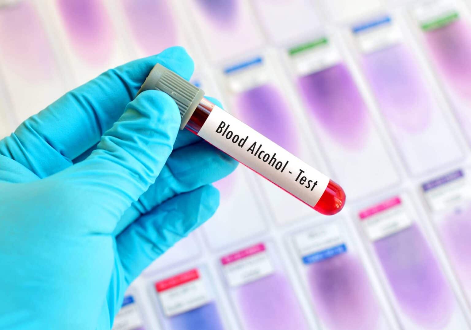 Blood Alcohol Concentration: A Guide to BAC Levels & Legal Limits