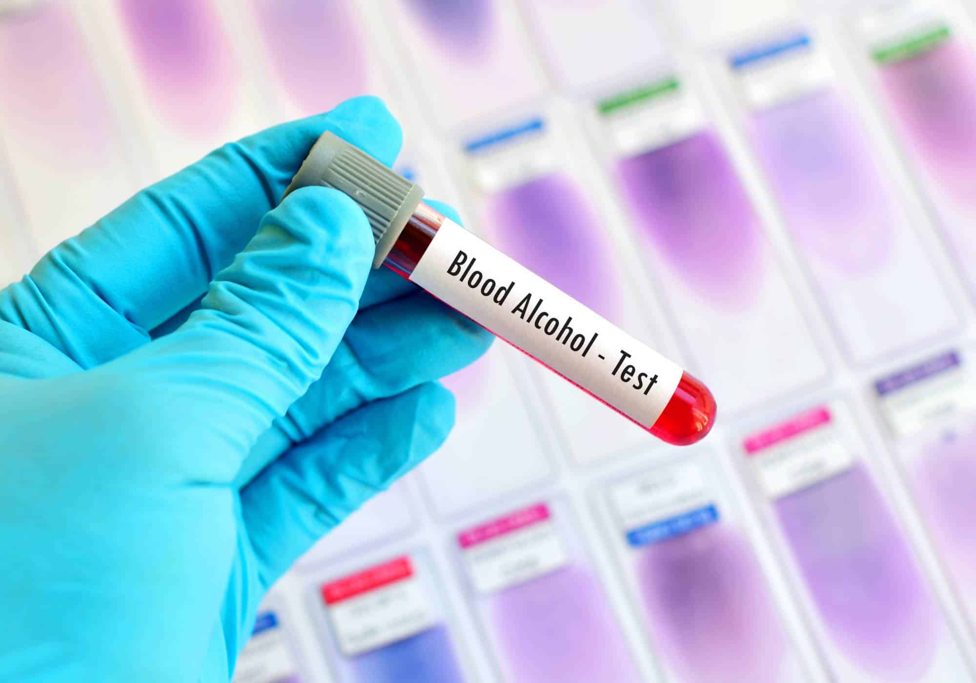 Blood Alcohol Concentration: A Guide to BAC Levels & Legal Limits