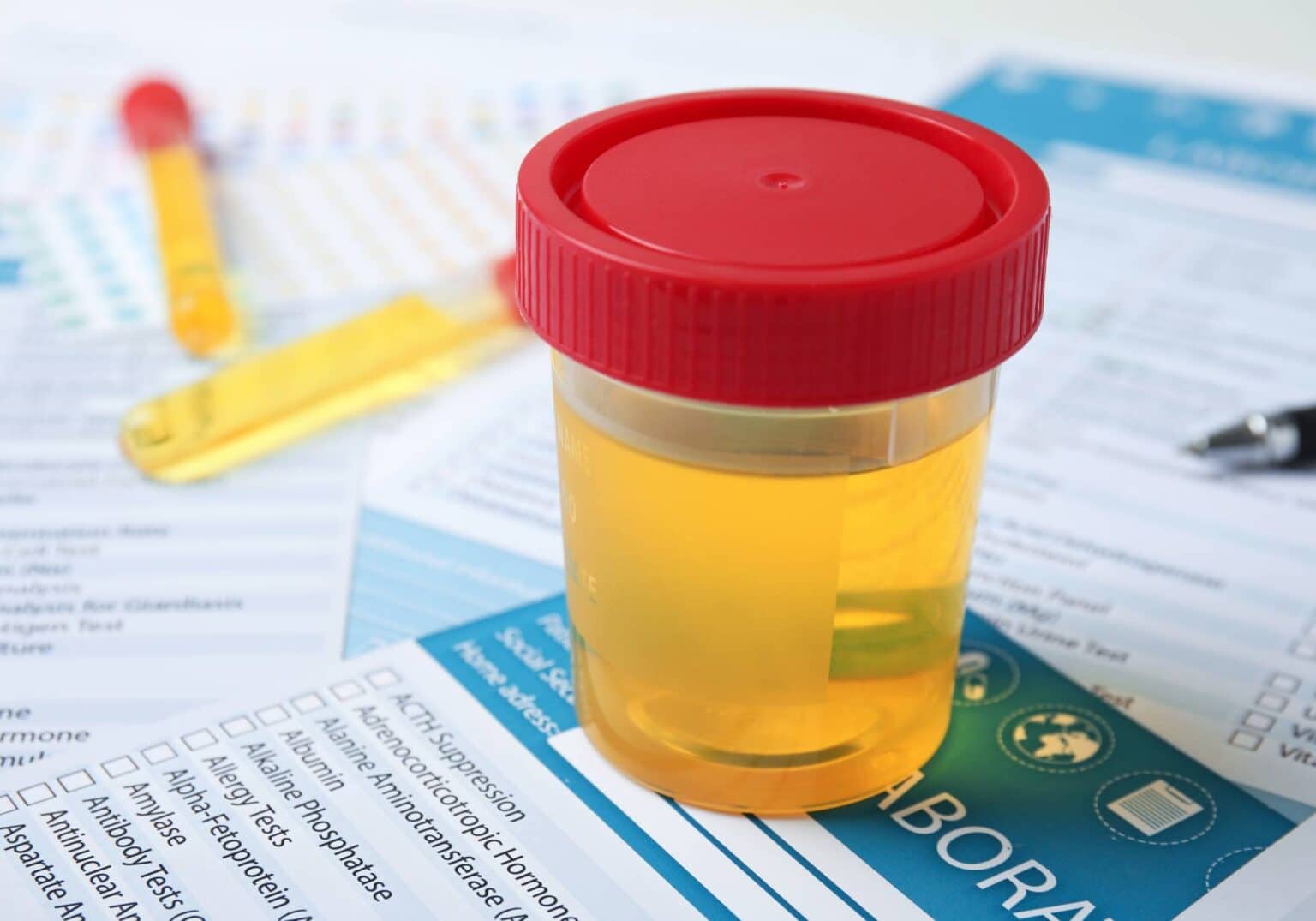 Can Weed Kill You? Marijuana Overdose