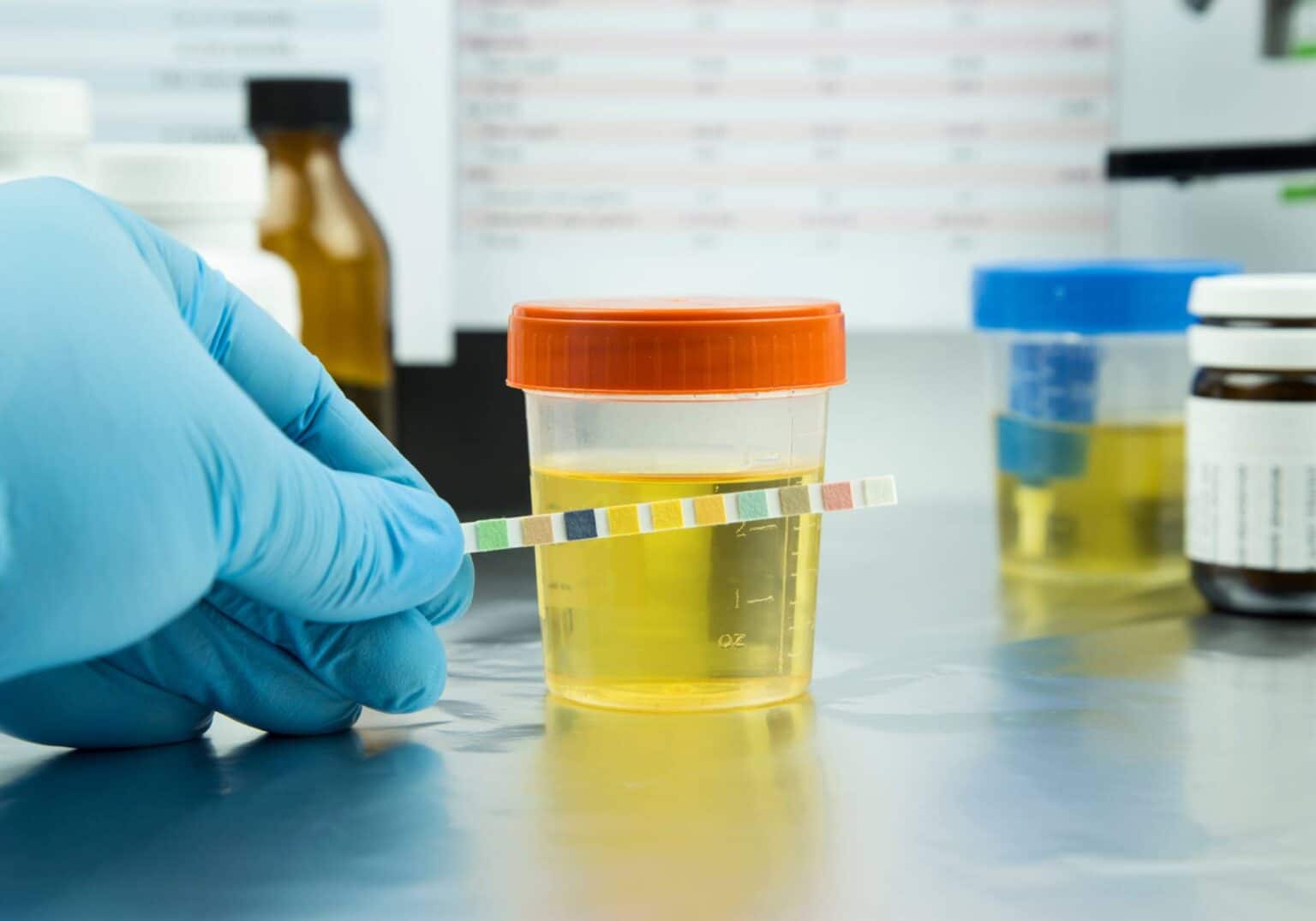 How Do Drug Tests Work? Types, Windows, and Cutoffs