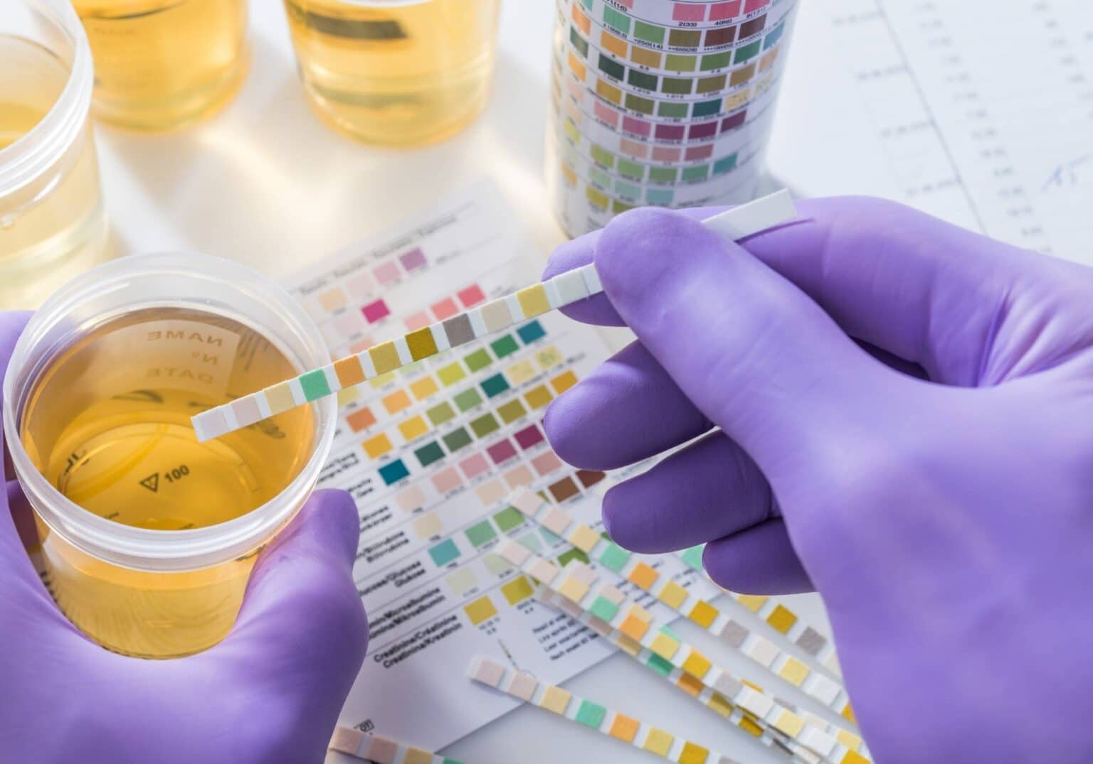 Fentanyl Test Strips: Accuracy, Use, and Safety Tips